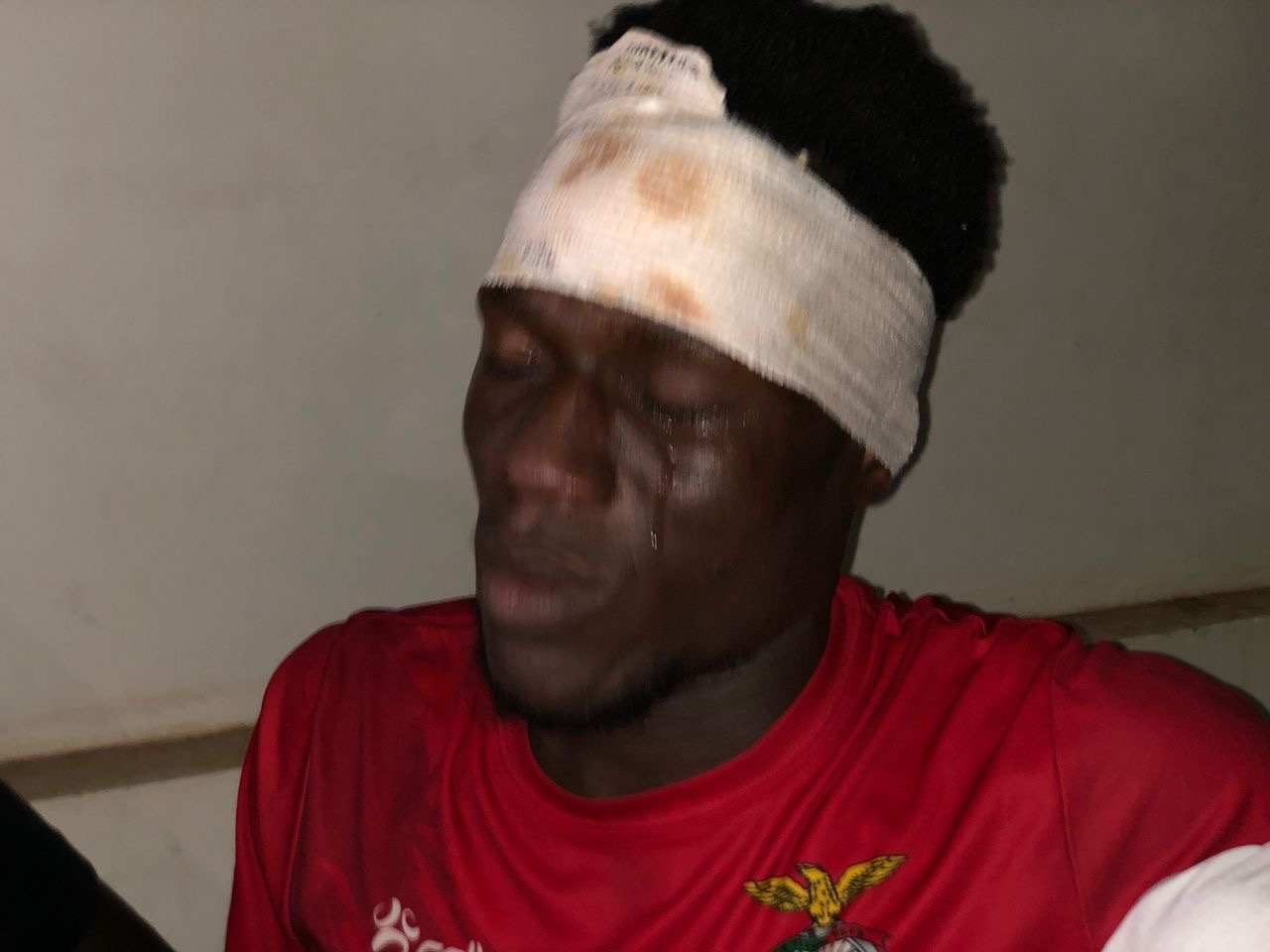 Liga Orange: JOGADOR DO BENFICA JEAN KALMENTE FOI AGREDIDO COM PEDRA ...